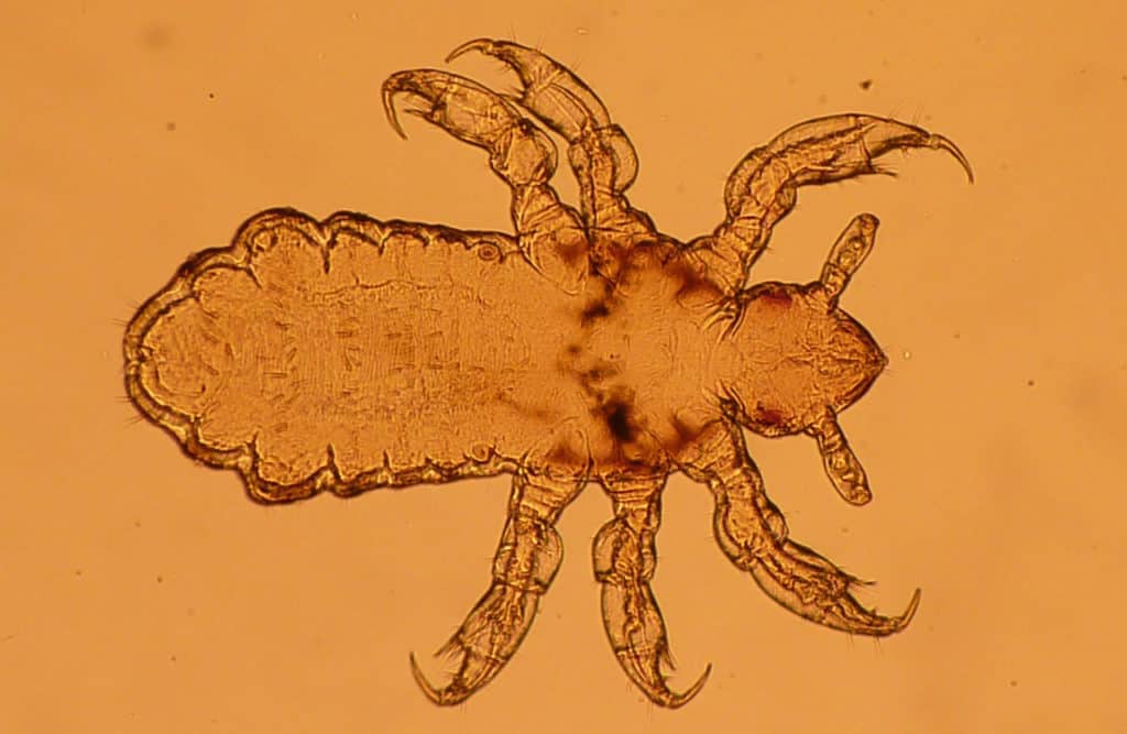 lice - Green Pest Services | Pest Control | Exterminator